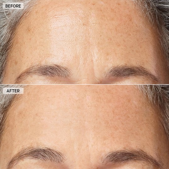 Corrector de Arrugas Power Redo | IL MAKIAGE